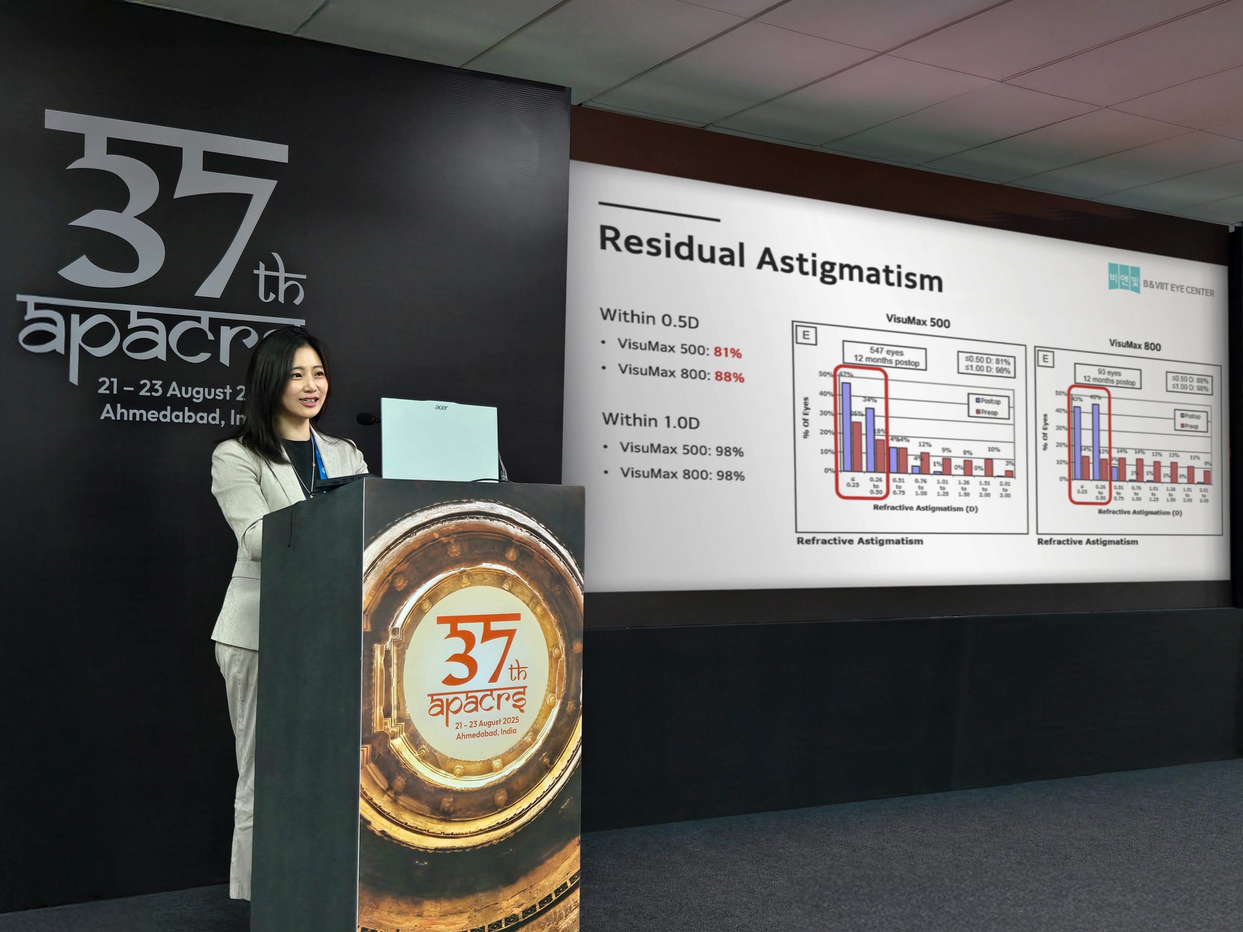 비앤빛안과, APACRS 2025에서 스마일프로 난시교정 임상결과 발표 - The 비앤빛 블로그